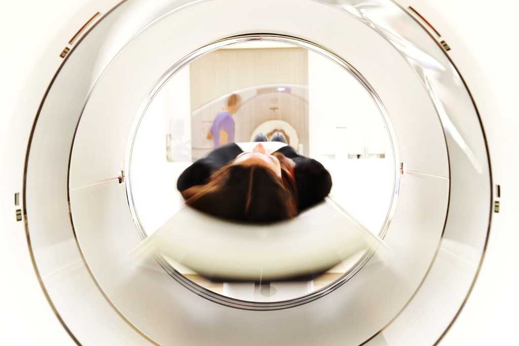 MRI scan